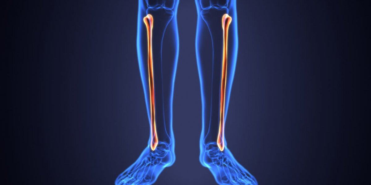 La importancia de tratar a tiempo la rotura de tibia y pe...